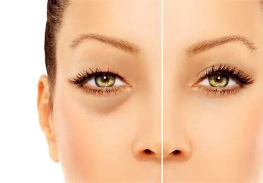 Remedios con aceites esenciales para las ojeras - Remedios Naturales.Net